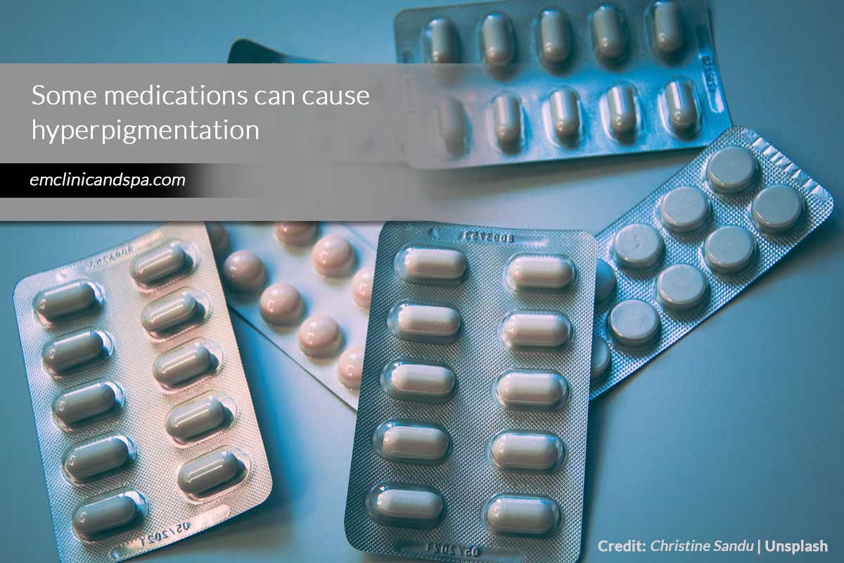 Types of Hyperpigmentation and How to Manage Them - em clinic Esthetic ...